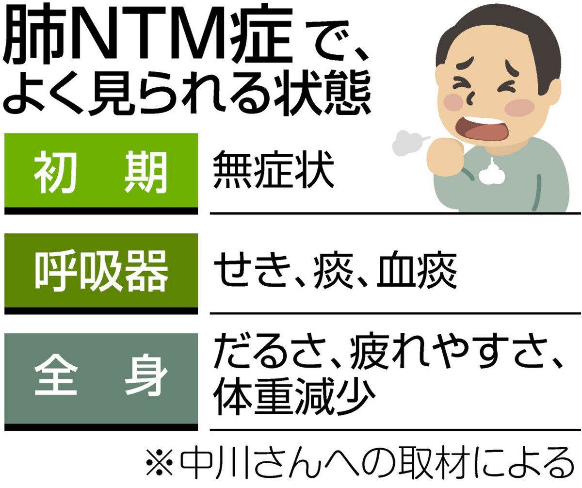 長引くせき、痰…肺NTM症かも 細菌感染 遅い進行、気付きにくく：東京新聞デジタル